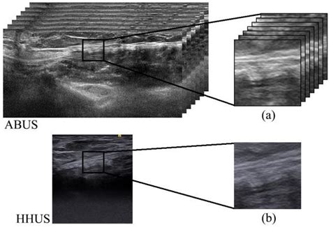 an illustrative example of a a 3d roi segmented from a reconstructed