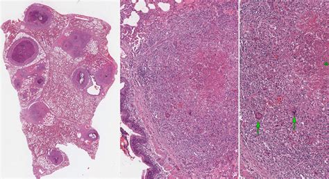 Respiratory Diseases Of Cattle Pathology Of The Respiratory System Of