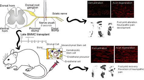 Late Bone Marrow Mononuclear Cell Transplantation In Rats With Sciatic