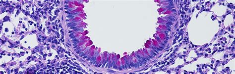 Mucus Inflammed Lung Tissue Artis The Jill Roberts Institute For