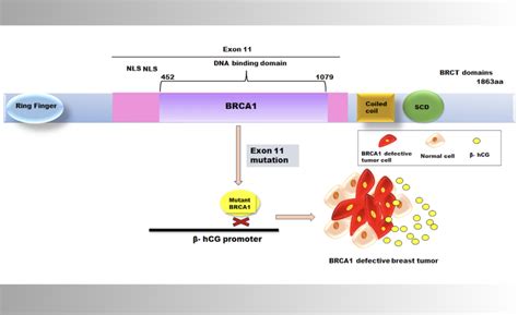 Understanding Brca1 Mutations In Breast Cancer Indiabioscience