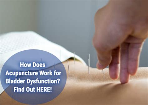 How Does Acupuncture Work For Bladder Dysfunction Find Out Here