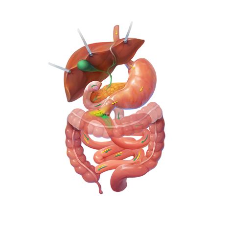 Single Anastomosis Duodeno Ileal Bypass Sadi Bariatric Surgery