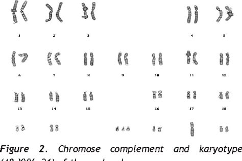 Double Trisomy