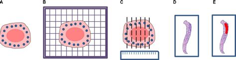 Processing Flow Of Endoscopic Submucosal Dissection Specimen A Download Scientific Diagram