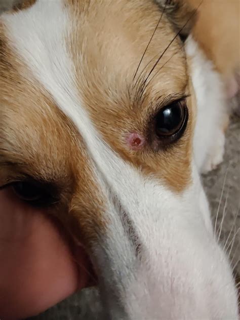 Persistent Lesion From Tick Bite Rvet
