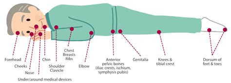 Ards And Prone Positioning