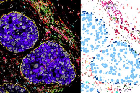 Ionpath Archives Inside Precision Medicine