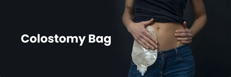 Colostomy Bag Management Tips For Daily Care And Hygiene
