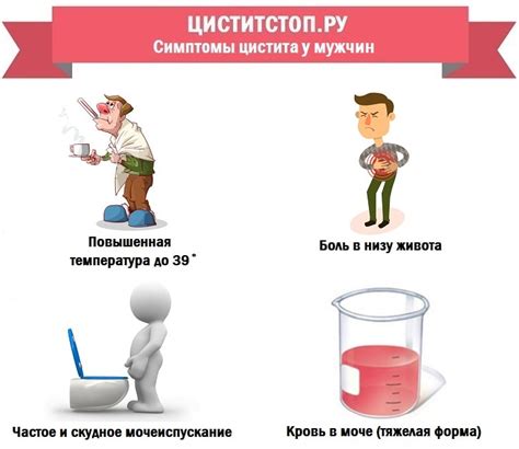 Цистит у мужчин: симптомы, лечение препараты, профилактика