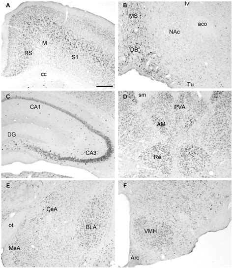 Examples Of Runx2 Immunolabeling In The Adult Mouse Brain Runx2