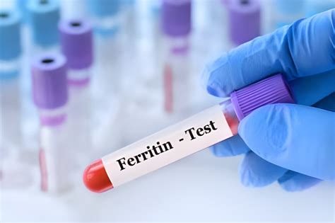 Normal Ferritin Levels Chart For Women Age Wise Essential Ferritin Ranges For Female Wellbeing