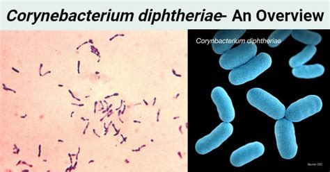 Corynebacterium Diphtheriae Klebs Löffler Bacillus An Overview