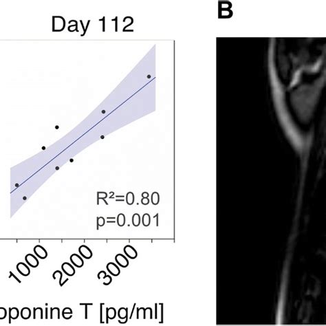 Pv Loop Analysis Of Diastolic Left Ventricular Function 56 And 112 Days