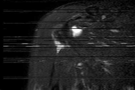 Dicomweb Json On Metadata Malforfated Json Error · Issue 26 · Marcelvanherkconquest Dicom