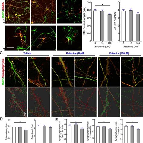 Ketamine Impairs Dendrites And Synapse Of Mature Spns A Comparison Of