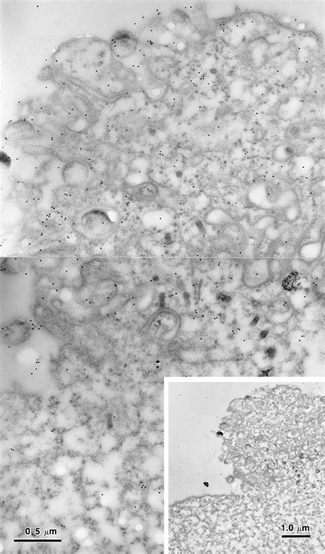 Ultrastructural Localization Of Myosin Ii Cells Were Induced To Cap