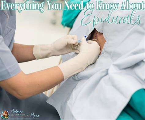 Everything You Need To Know About Epidurals