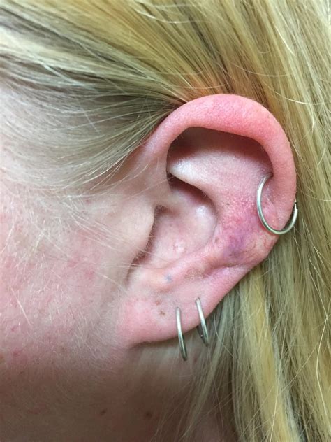 Ear Piercing Aftercare Healing Science Hygiene Protocols And Long Term