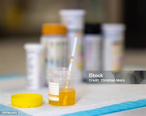 Urine Analysis And Urinary Test Using A Dipstick In A Laboratory Stock
