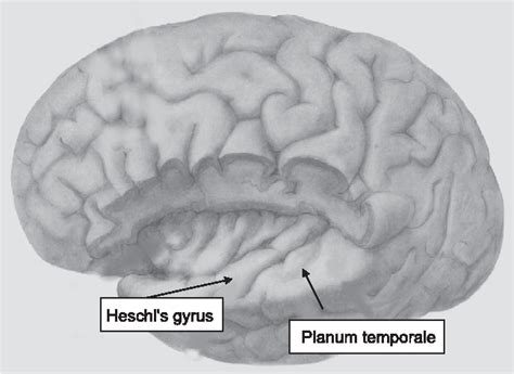 figure 1 from lateralization of auditory cortex functions semantic