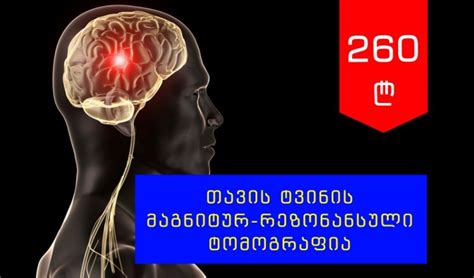 თავის ტვინის მაგნიტურ რეზონანსული ტომოგრაფია