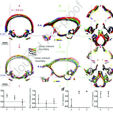 The Stereotactic Positioning Bias And Reproducibility A Cranial