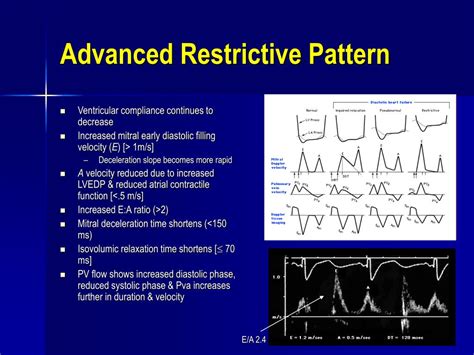 Ppt Restrictive Cardiomyopathy Powerpoint Presentation Free Download