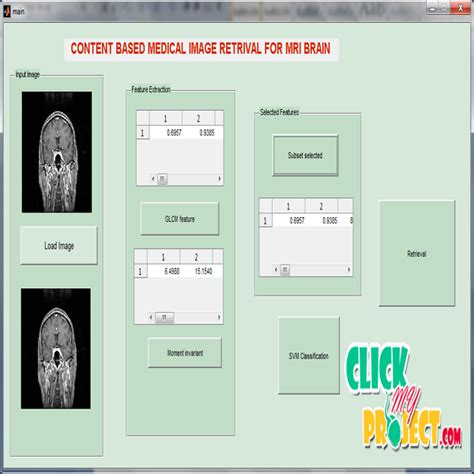 Content Based Image Retrieval For Medical Mri Brain Images Clickmyproject