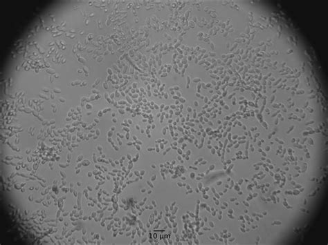 Yeast Contamination In Wyeast Pediococcus 5733 Homebrew Talk Beer