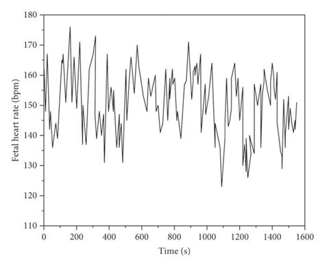 Baseline Detection And Analysis Of Fetal Heart Rate Download Scientific Diagram