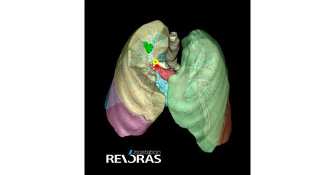 Olympus Announces Launch Of Ai Powered Surgical Planning Tool Through… Rajeev Taitriya