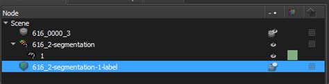 Difference Between Segmentation Dimensions And Original Dimensions Support D Slicer Community