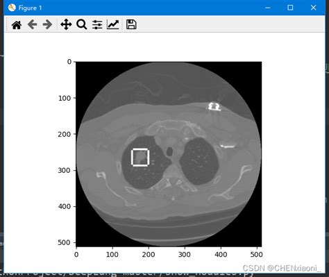 Luna16结节可视化及世界（ct坐标与体素（图像）坐标的转换luna16同一张图片为什么不一样 Csdn博客