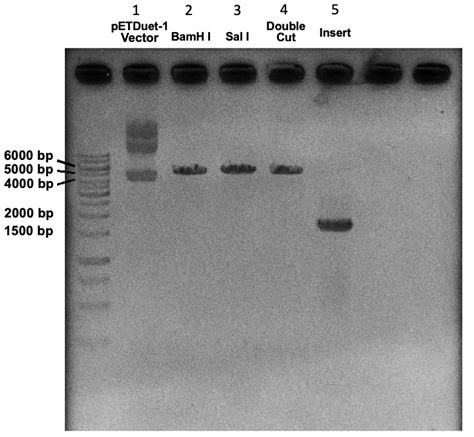 Why Is There Only 1 Band Appearing After Double Restriction Enzyme
