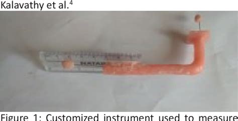 Figure 2 From Lateral Throat Form Classification Using A Customized