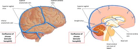 Confluence Of Sinuses