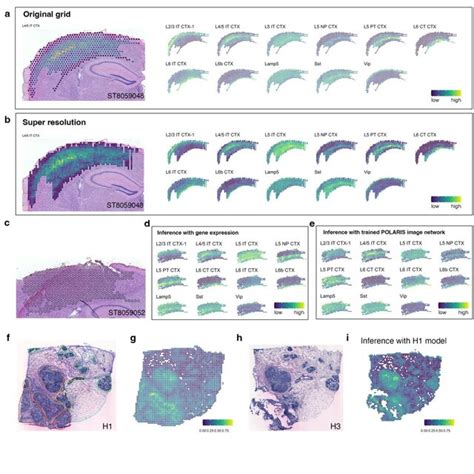 Polaris Achieves Super Resolution Cell Composition Inference When