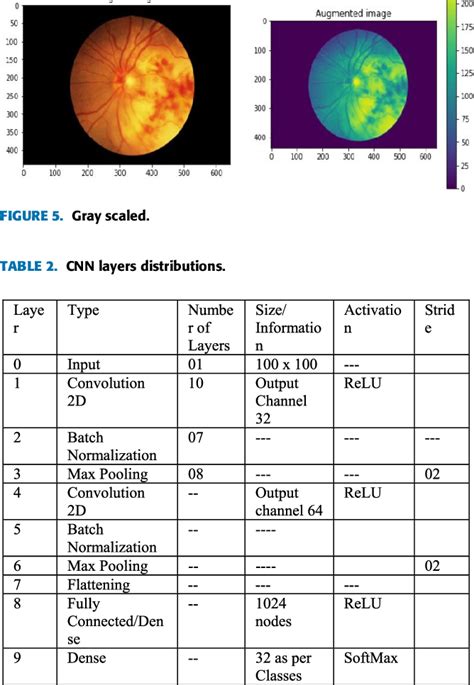 Figure 1 From Multi Class Retinal Diseases Detection Using Deep Cnn