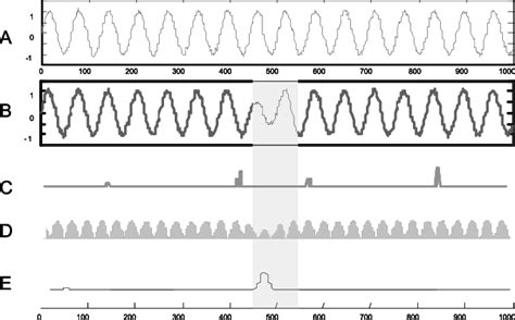 A Comparison Of Three Anomaly Detection Algorithms On One Of The