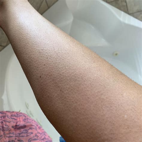 Nood Reviews Complaints Ratings