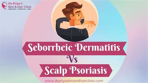 Scalp Psoriasis Vs Seborrheic Dermatitis Pdf