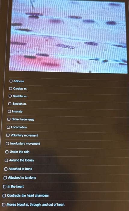 Solved Select All Answer Choices That Are Trye For The