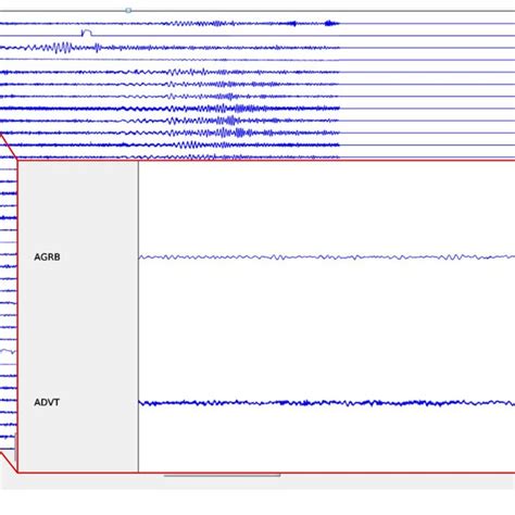 2 Picking Example Of An Event With All Available Waveforms At