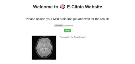 Github Nouramedhat28brain Tumor Classification Cnn With Deployment