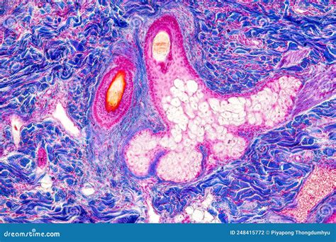 Scalp And Hair Follicles Of Human Under The Microscope Stock Photo Image Of Beauty