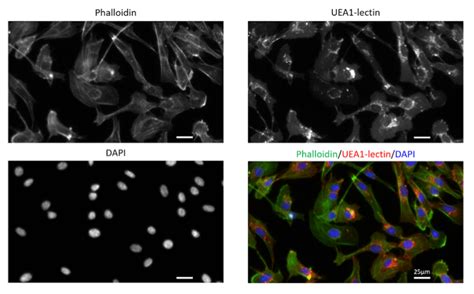 Automated Immunofluorescence Using A Sequential Flow Injection System