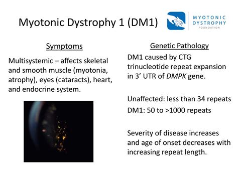Ppt Analysis Of Differential Gene Expression In A Myotonic Dystrophy