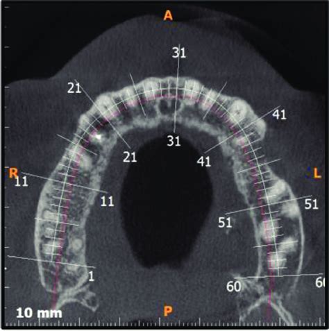 Cone Beam Computed Tomography Records Anatomical Structures Three Download Scientific Diagram