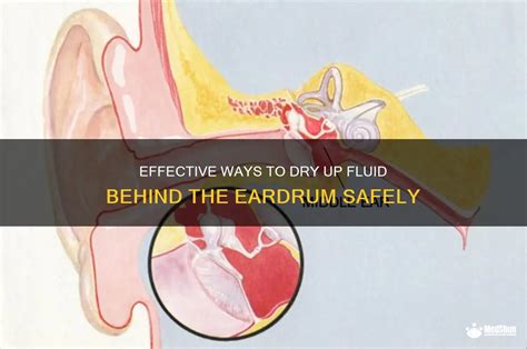 Effective Ways To Dry Up Fluid Behind The Eardrum Safely Medshun